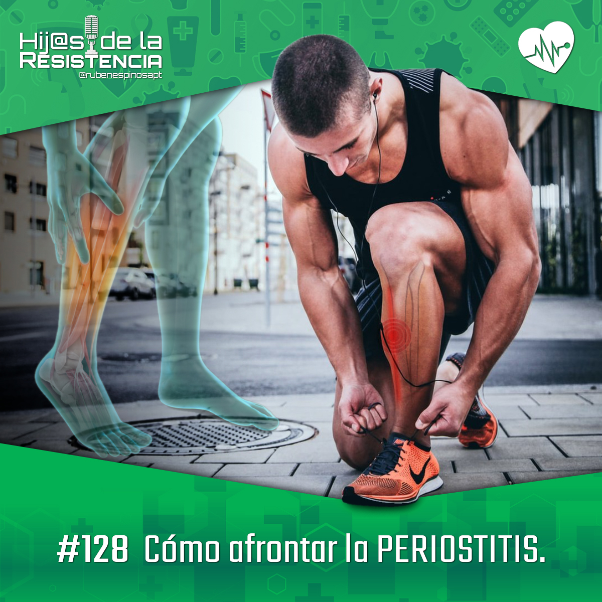 Periostitis, cómo afrontarla.